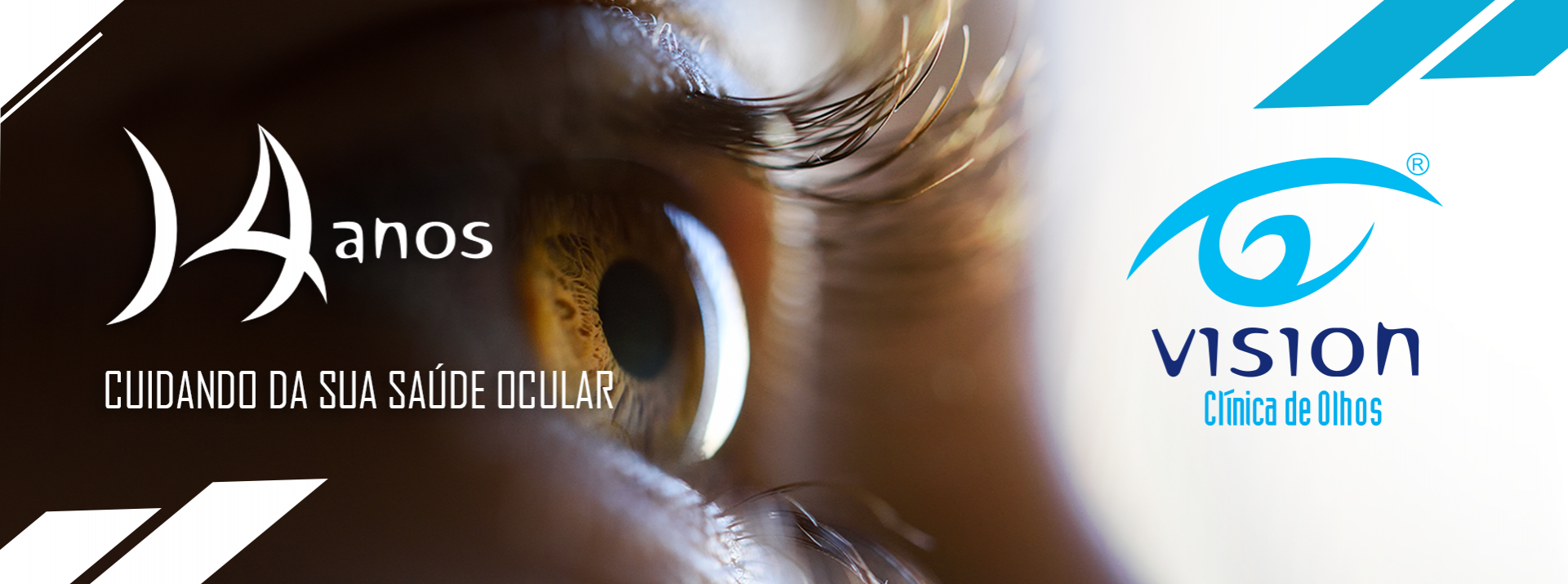 Vision Clínica de Olhos